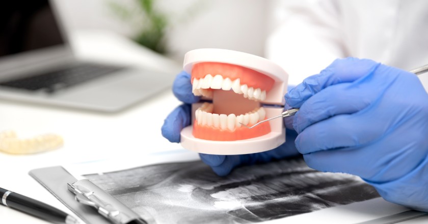 Common Dental Problems and How to Prevent Them